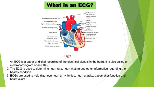 ECG EU.pptx