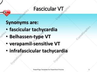 ECG F | PPT