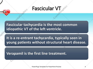 ECG F | PPT