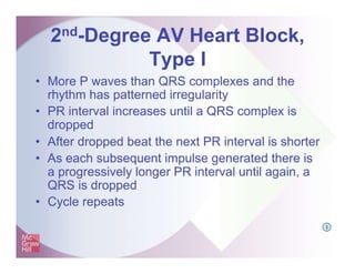 ecg_fast_and_easy_chp12_compressed.pdf