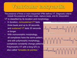 ECG, rapid review of essential topics | PPTX