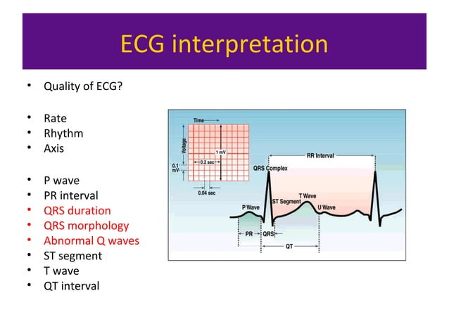 Ecg interpretation | PPT