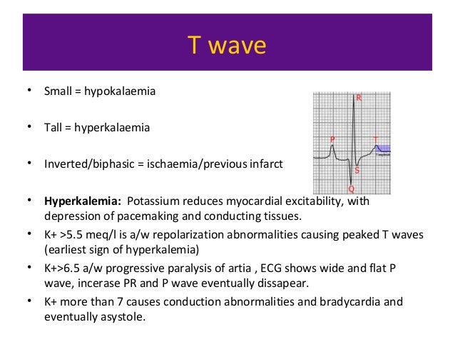 Ecg interpretation