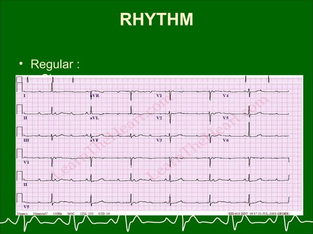 ECG Final Proff.Sumit Kr Ghosh Dept of Internal Medicine Medical ...