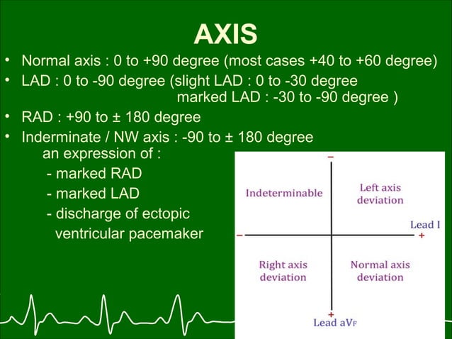 ECG Final Proff.Sumit Kr Ghosh Dept of Internal Medicine Medical ...