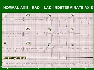 ECG Final Proff.Sumit Kr Ghosh Dept of Internal Medicine Medical ...