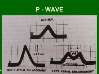 ECG Final Proff.Sumit Kr Ghosh Dept of Internal Medicine Medical ...
