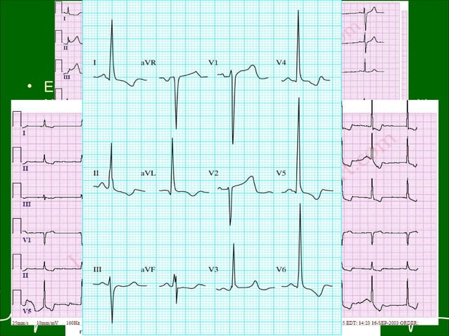 ECG Final Proff.Sumit Kr Ghosh Dept of Internal Medicine Medical ...