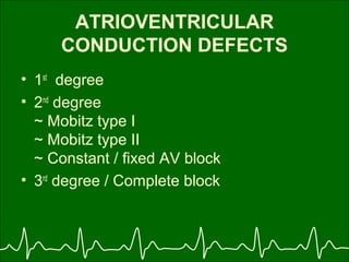 ECG Final Proff.Sumit Kr Ghosh Dept of Internal Medicine Medical ...