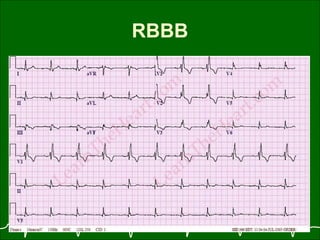 ECG Final Proff.Sumit Kr Ghosh Dept of Internal Medicine Medical ...