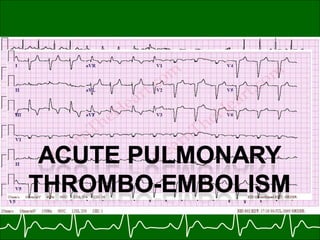 ECG Final Proff.Sumit Kr Ghosh Dept of Internal Medicine Medical ...