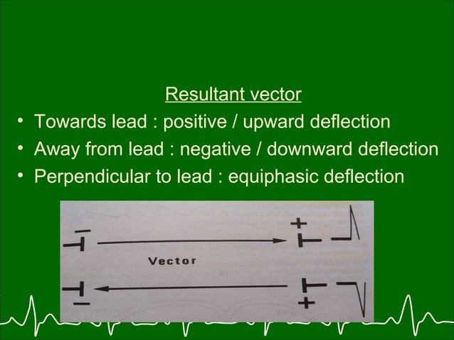 ECG Final Proff.Sumit Kr Ghosh Dept of Internal Medicine Medical ...