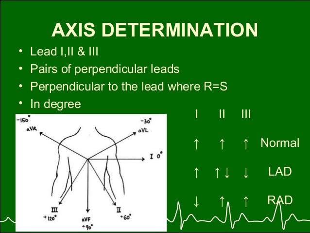 ECG Final Proff.Sumit Kr Ghosh Dept of Internal Medicine Medical Coll…