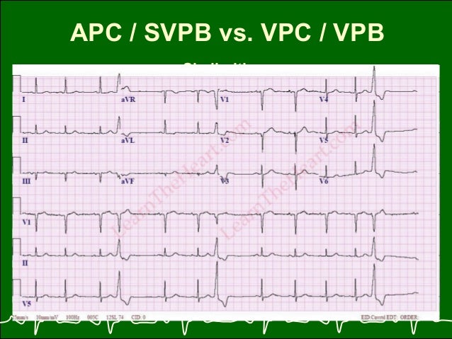 ECG Final Proff.Sumit Kr Ghosh Dept of Internal Medicine Medical Coll…