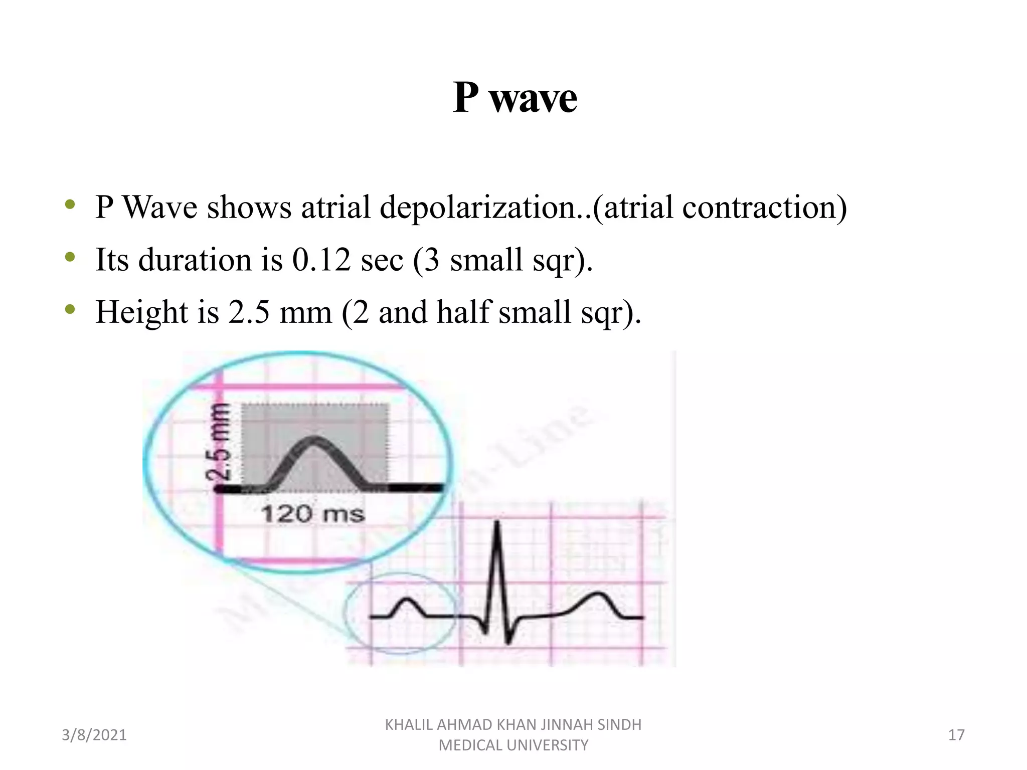 Basic of ECG with common abnormalities. | PPTX
