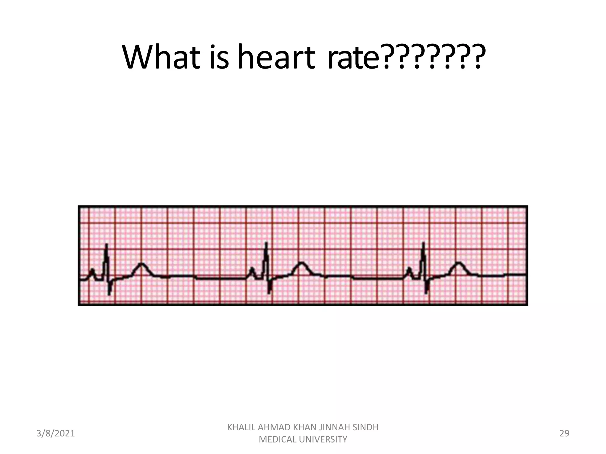 Basic of ECG with common abnormalities. | PPTX