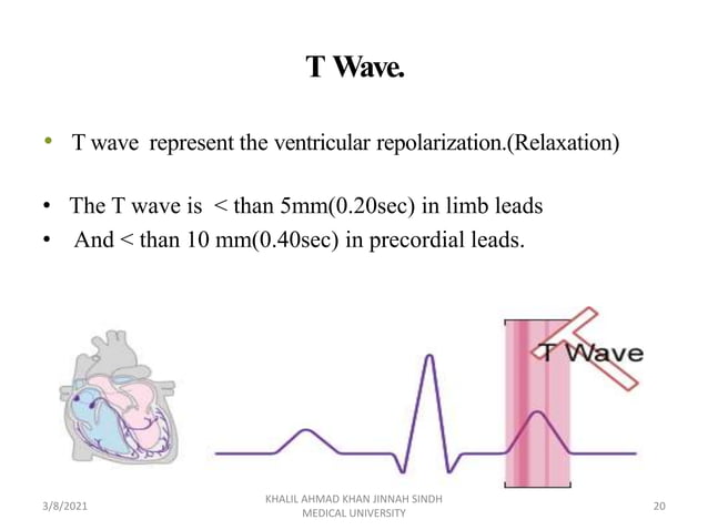 Basic of ECG with common abnormalities. | PPTX | Heart and ...
