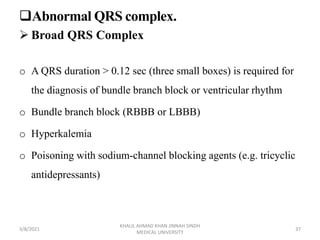 Basic of ECG with common abnormalities. | PPTX