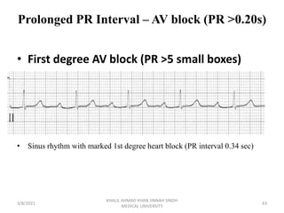 Basic of ECG with common abnormalities. | PPTX