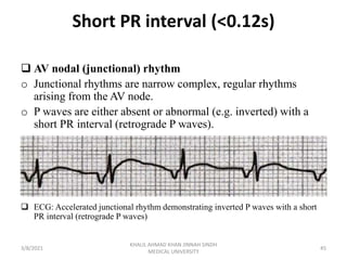 Basic of ECG with common abnormalities. | PPTX