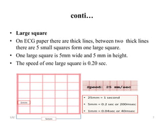 Basic of ECG with common abnormalities. | PPTX