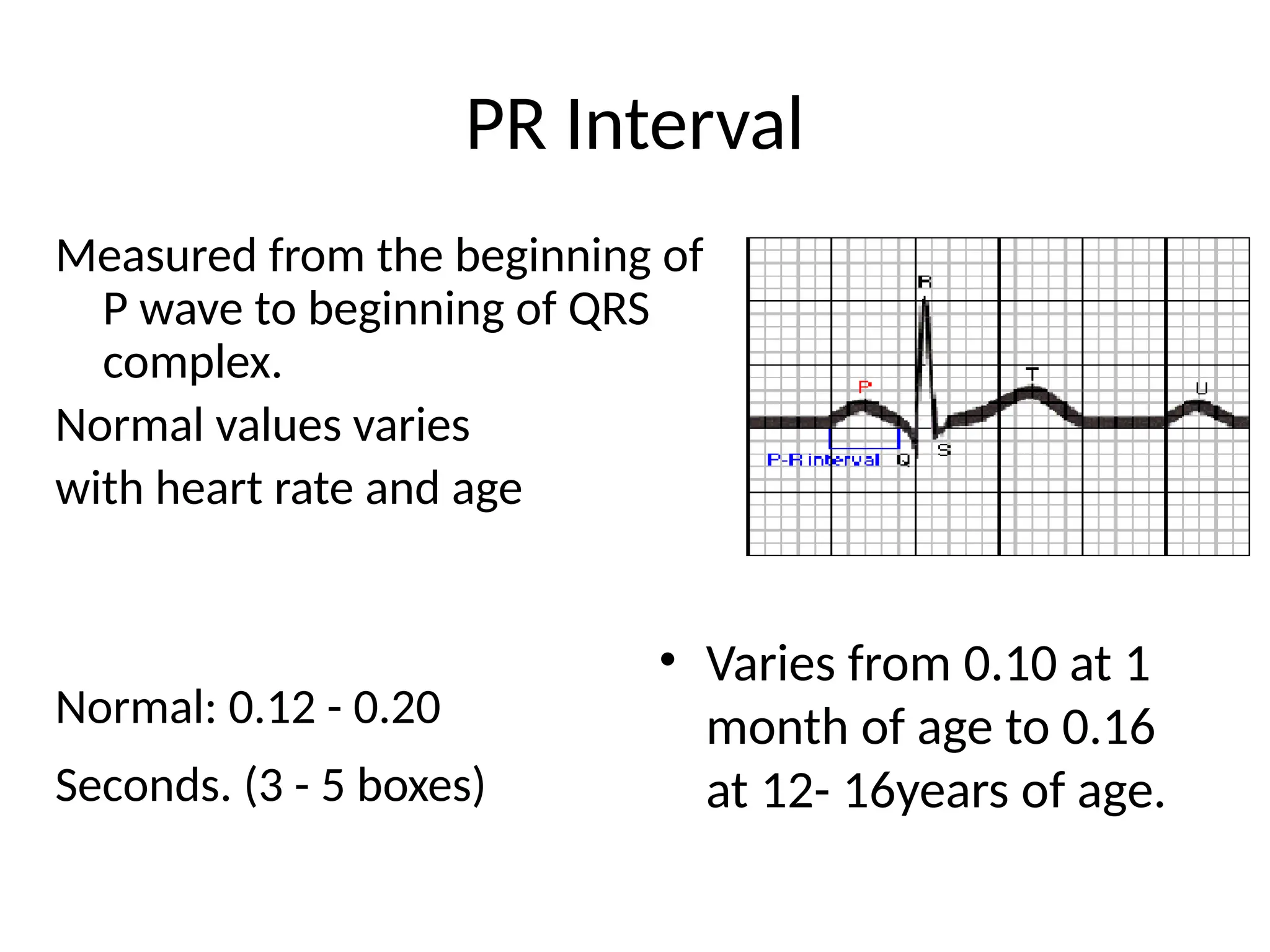 ECG final.pptx cardiology newborn very essential | PPT