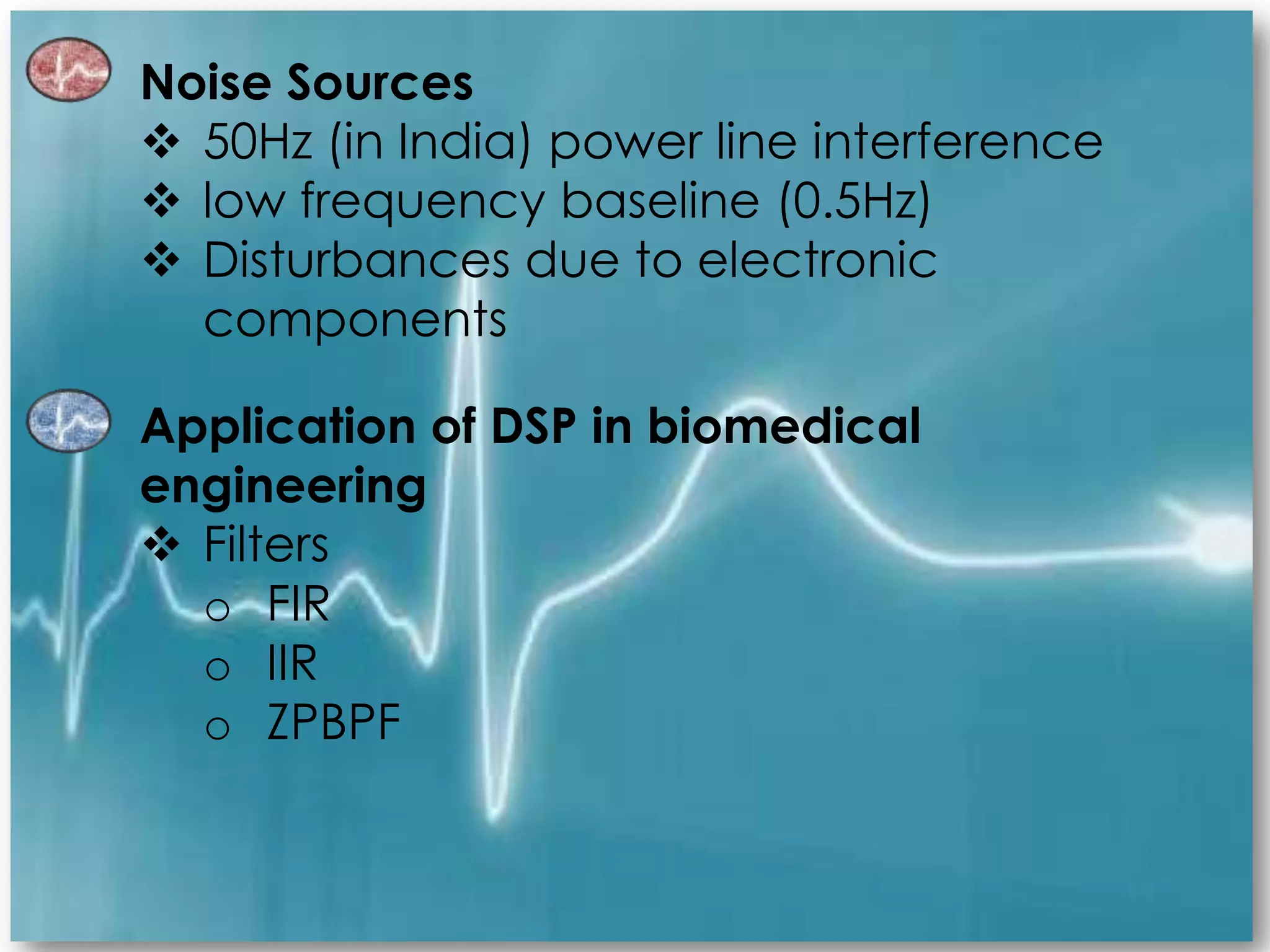 Ecg Signal Processing | PPTX