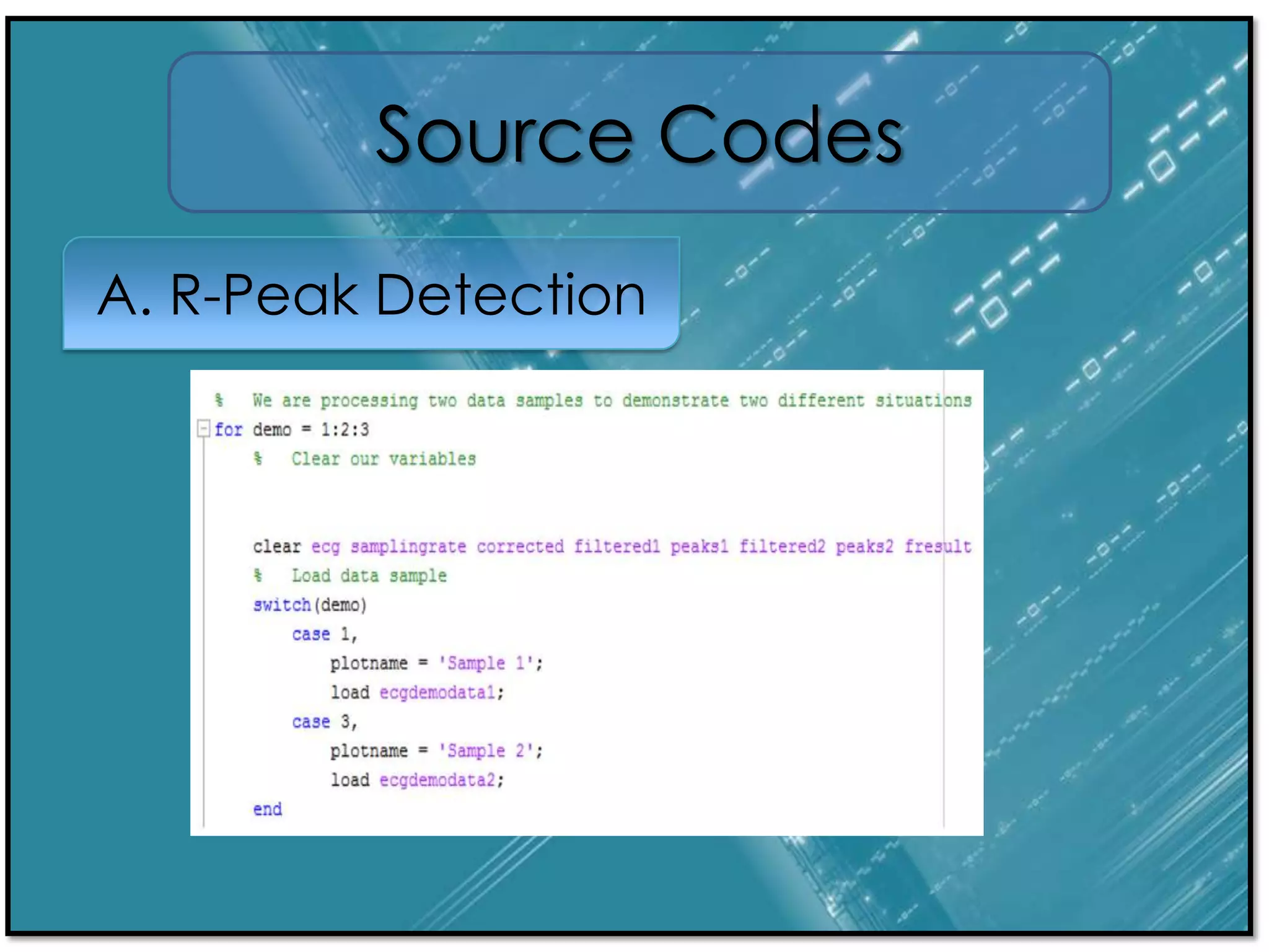 Ecg Signal Processing | PPTX