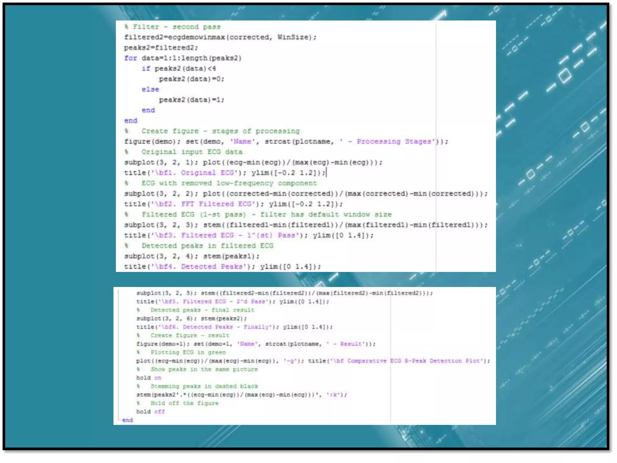 Ecg Signal Processing | PPTX