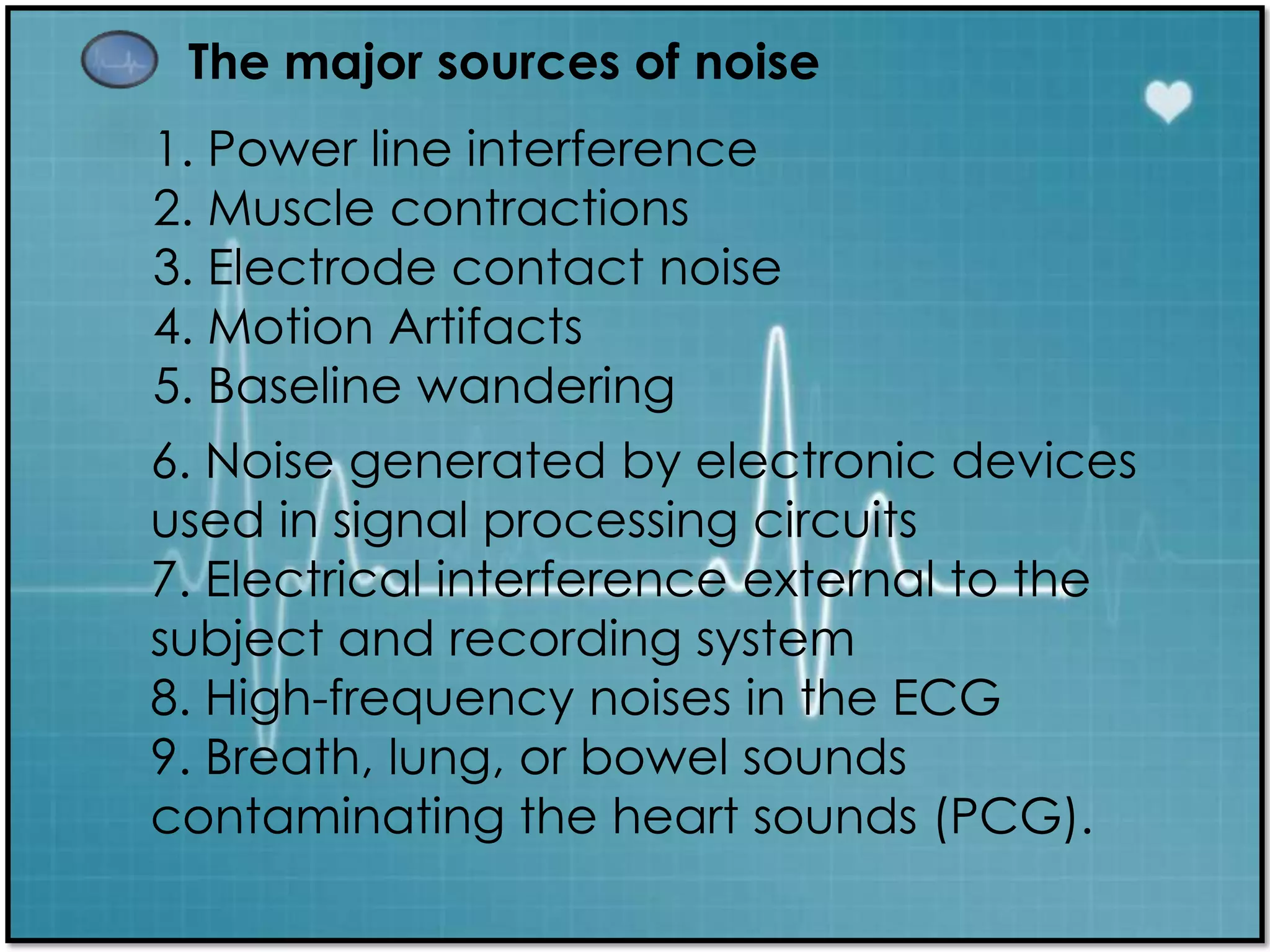 Ecg Signal Processing | PPTX