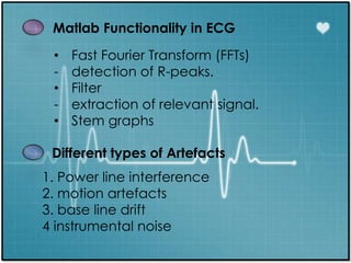 Ecg Signal Processing | PPTX