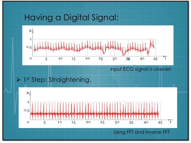 Ecg Signal Processing