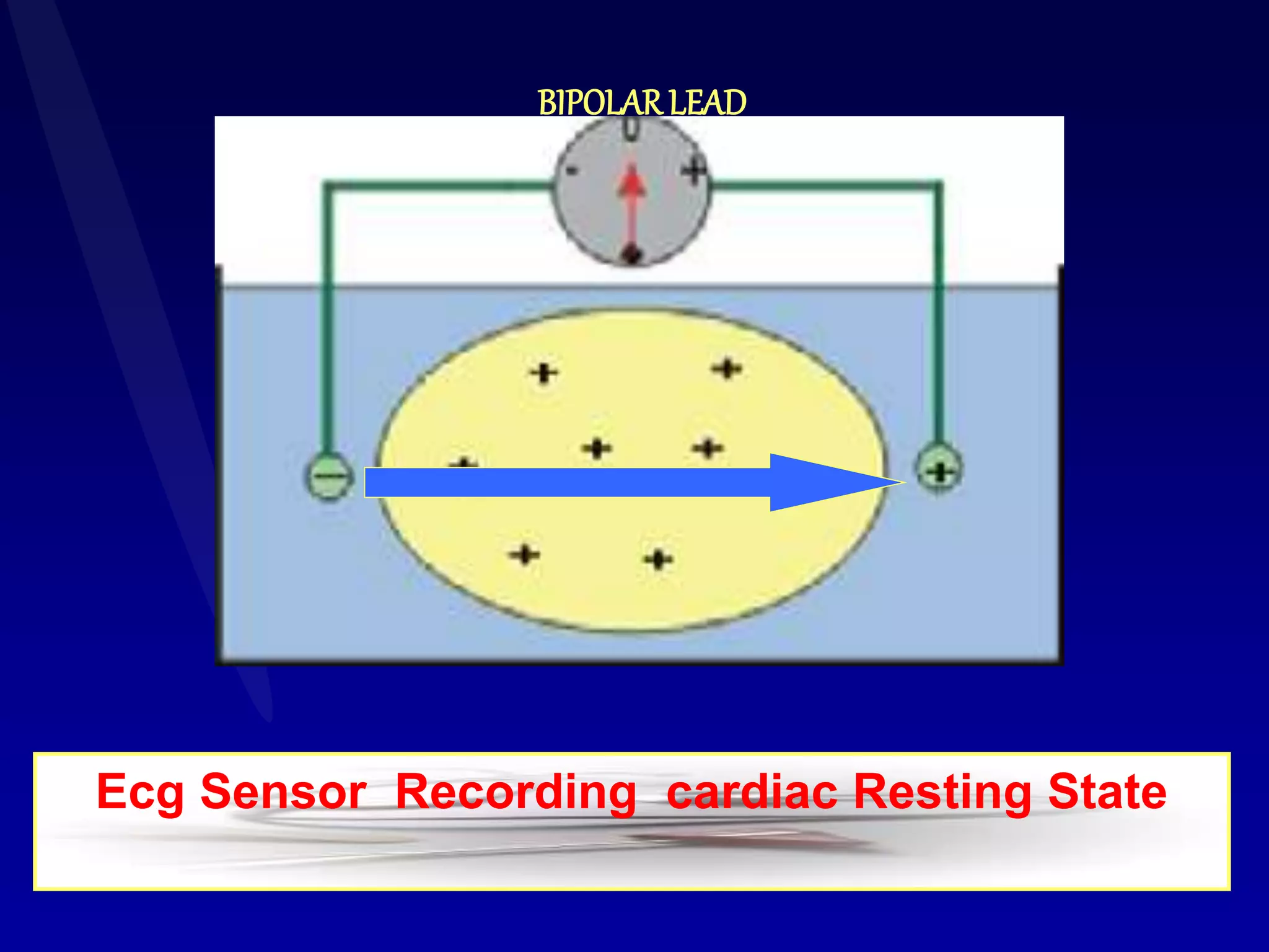 Ecg final the best | PPT