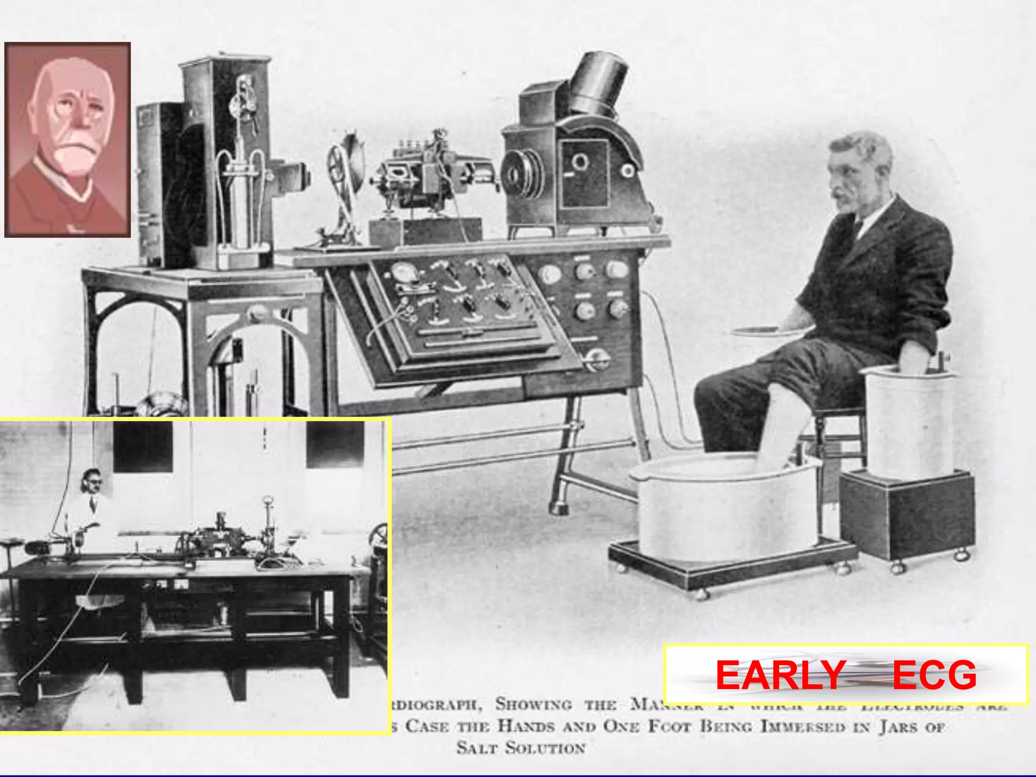 Ecg final the best | PPT