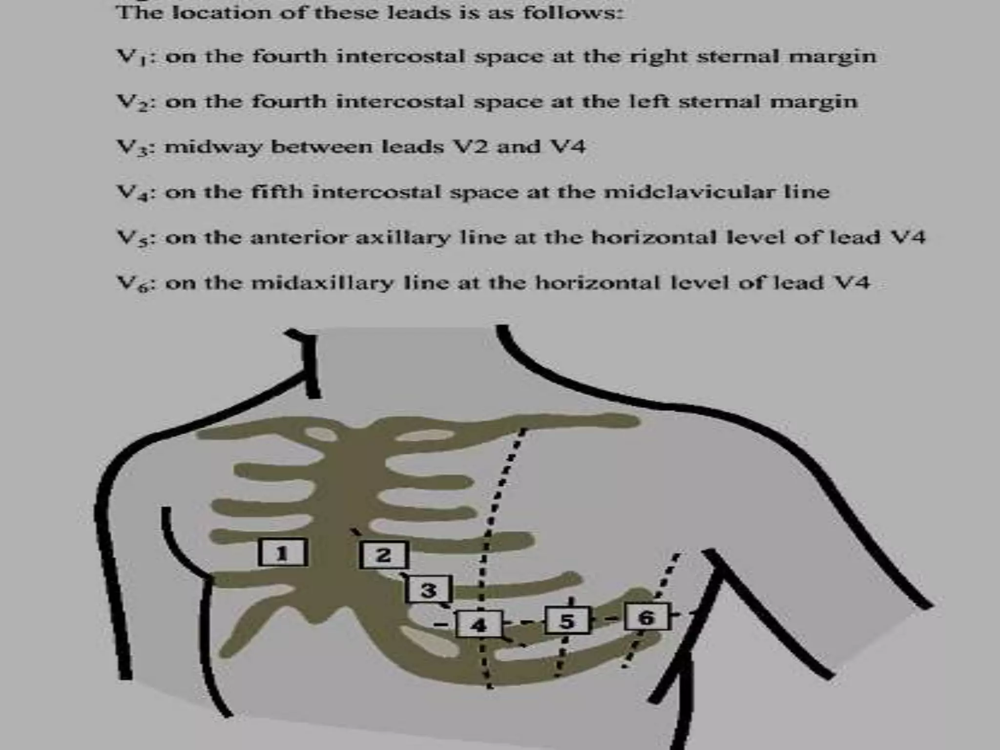 Ecg final the best | PPT