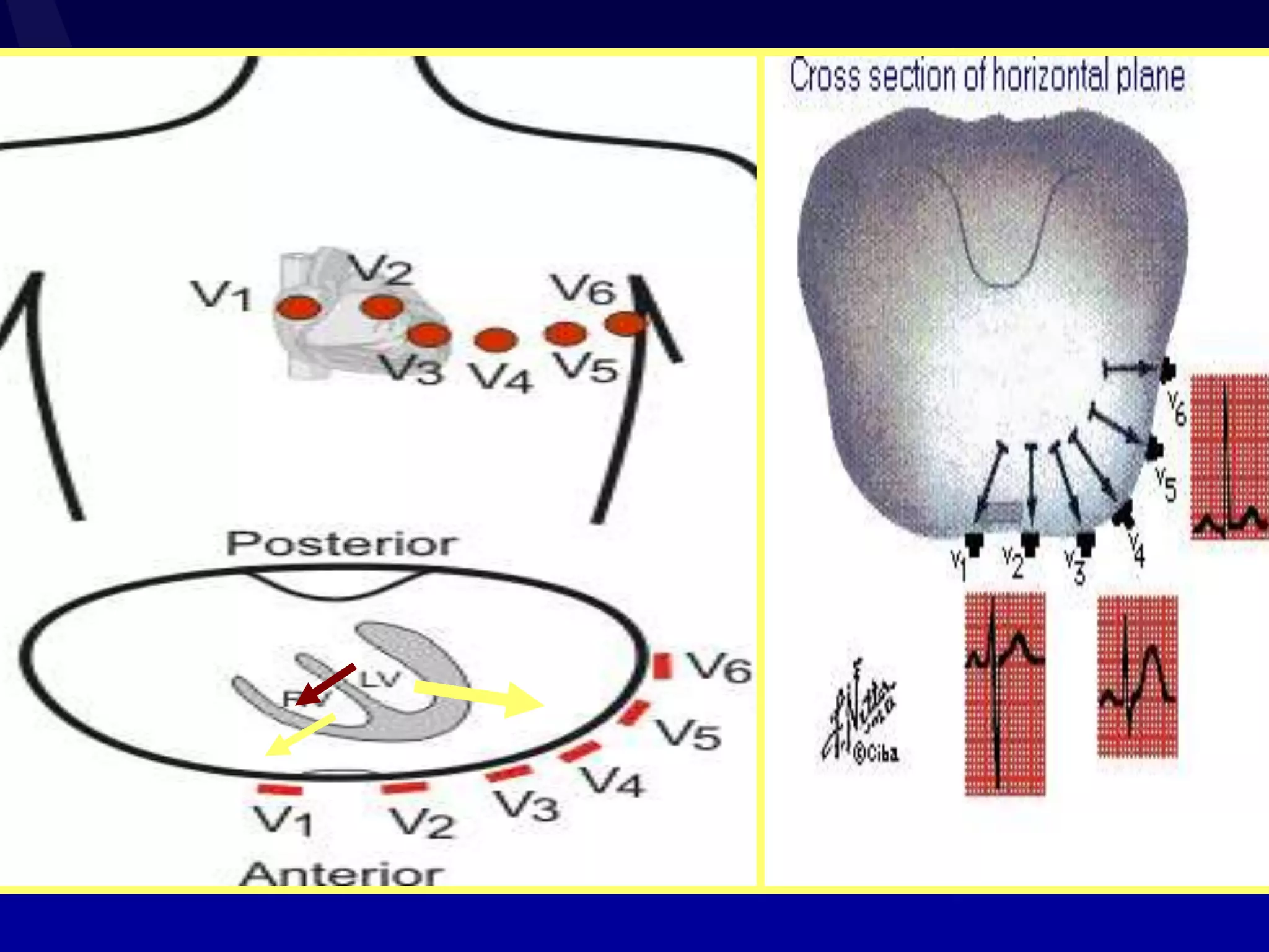Ecg final the best | PPT