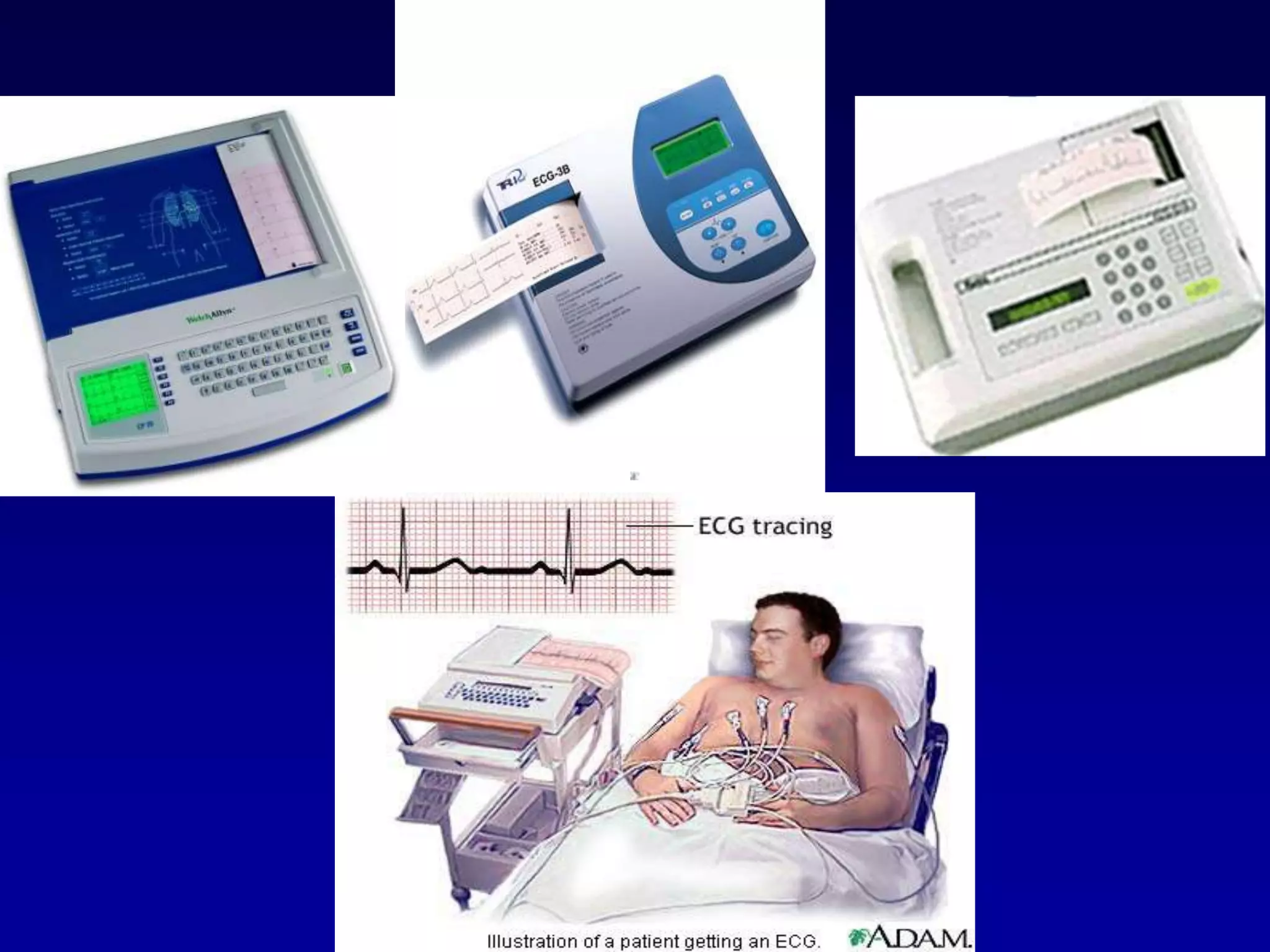 Ecg final the best | PPT