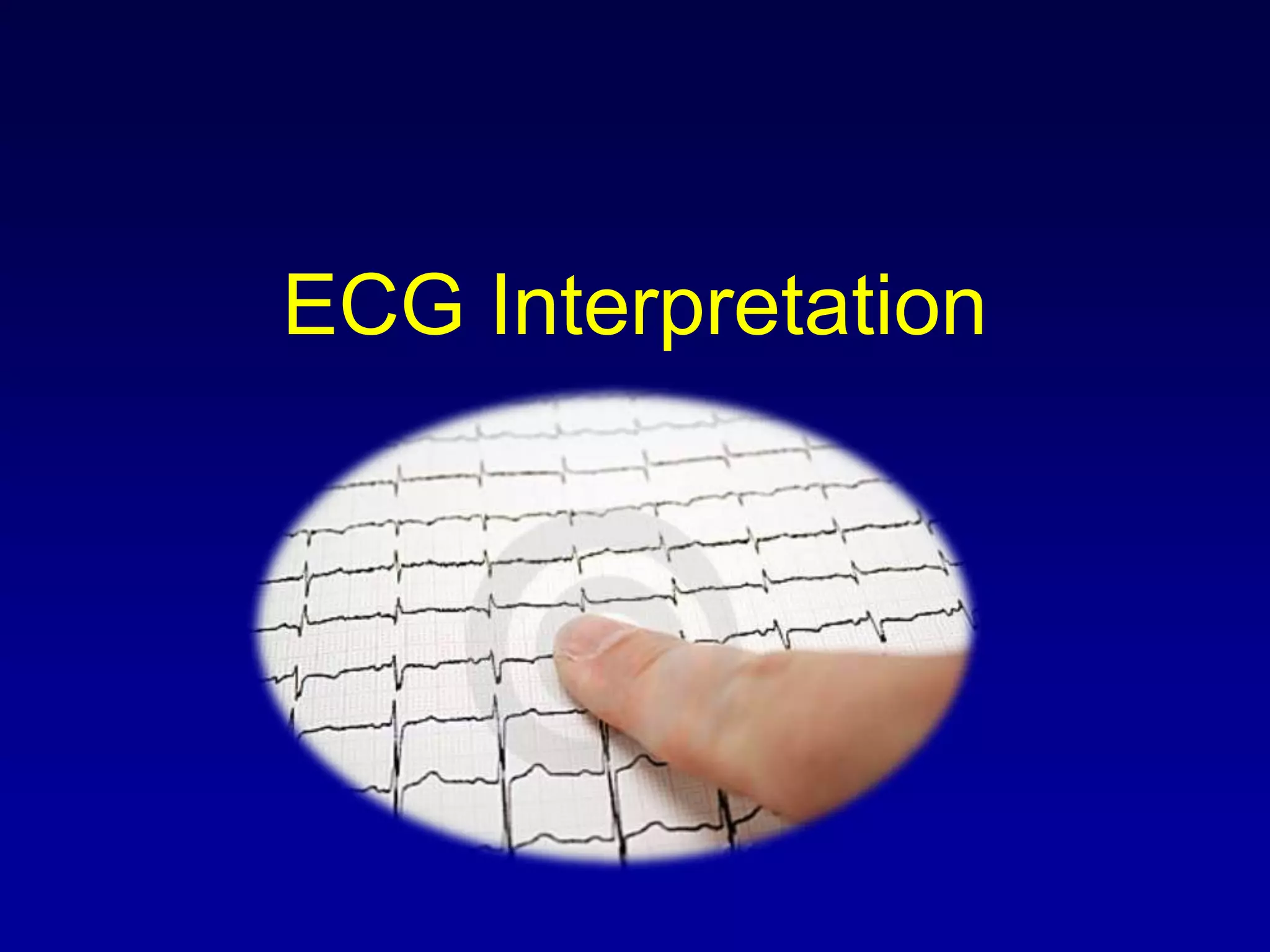 Ecg final the best | PPT