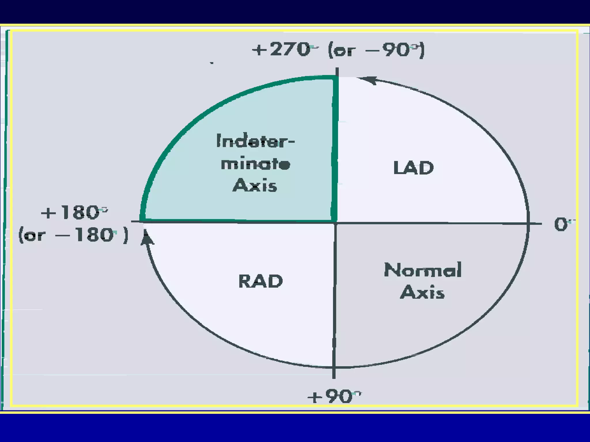 Ecg final the best | PPT