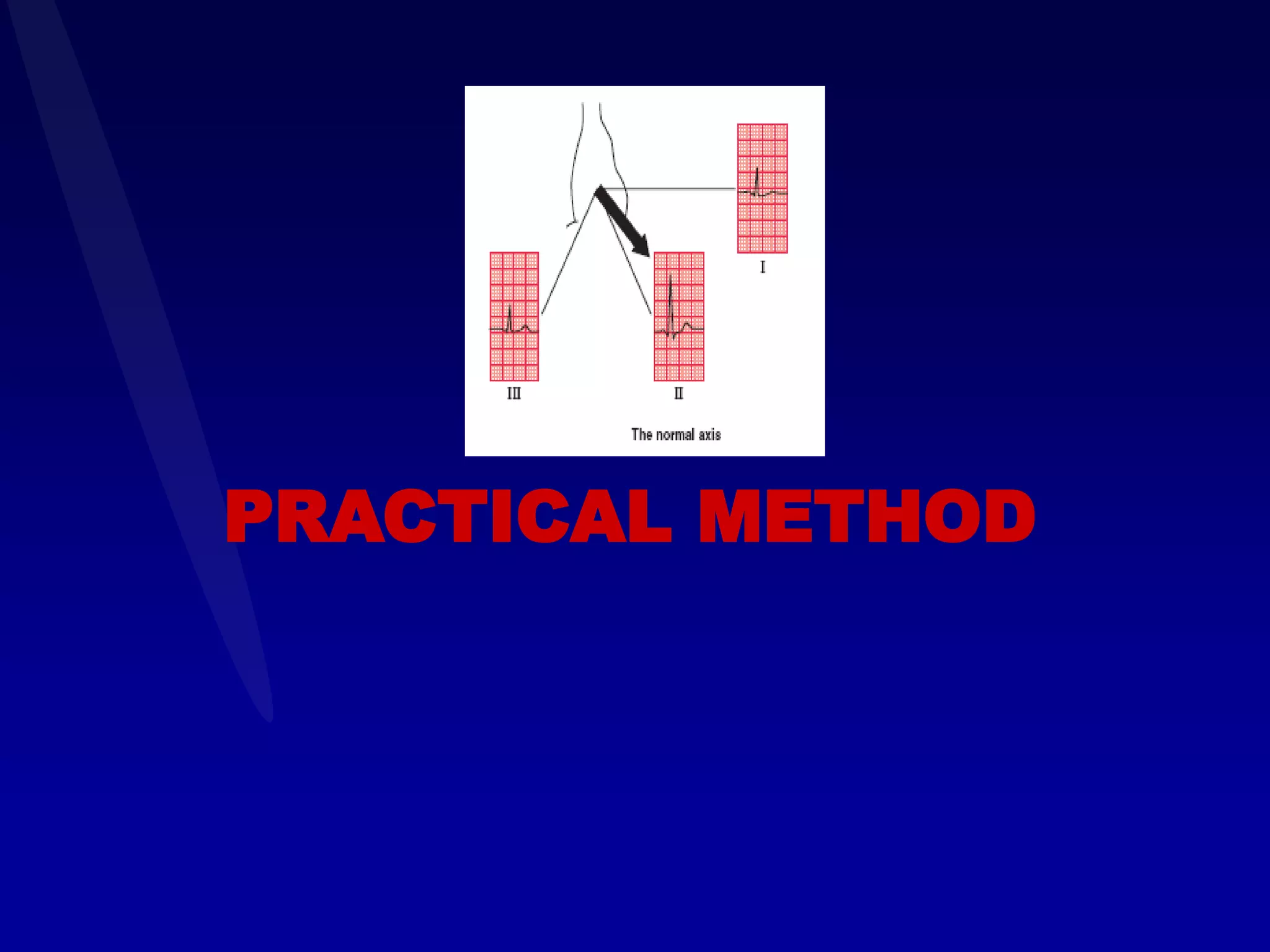 Ecg final the best | PPT