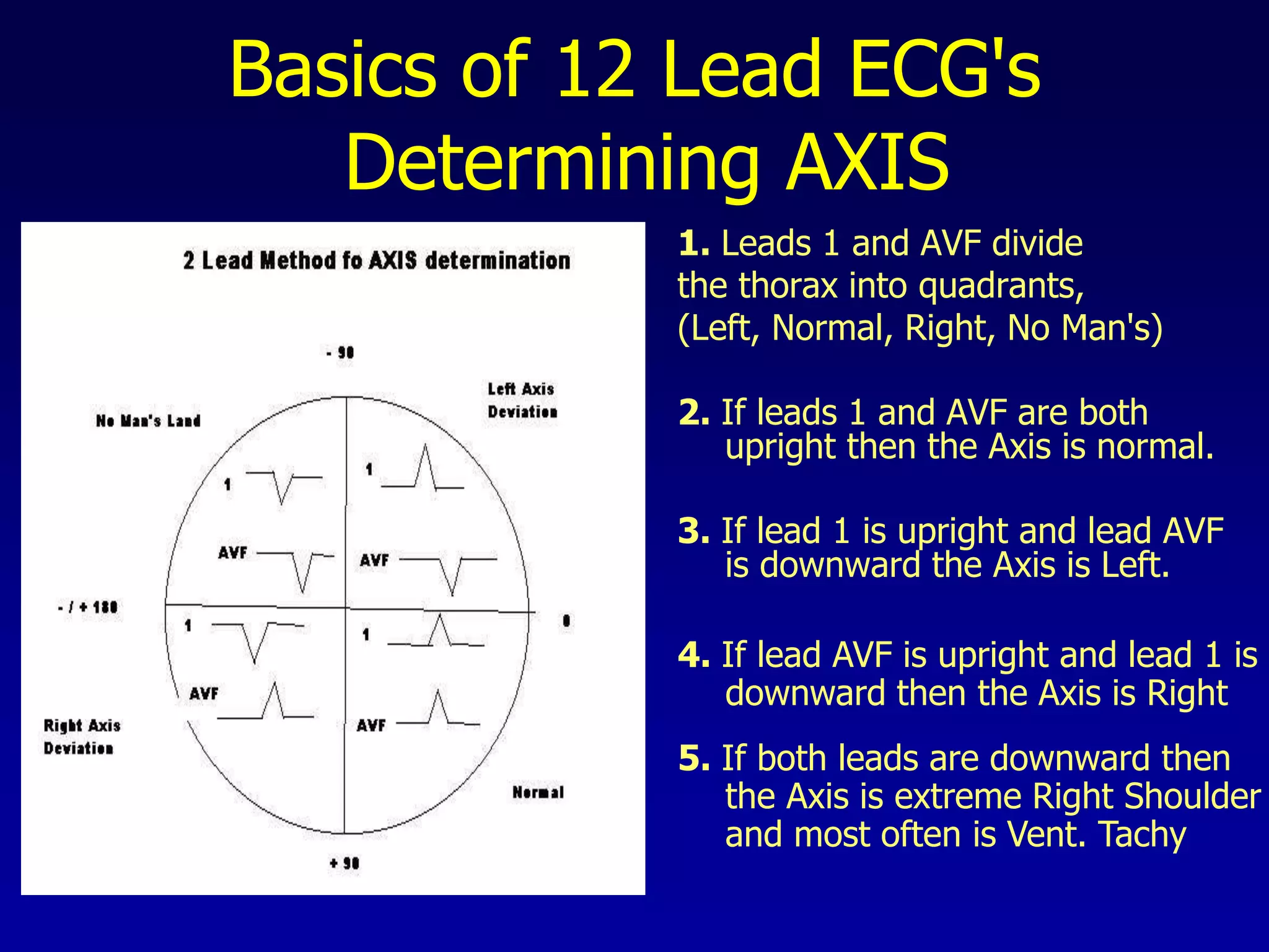Ecg final the best | PPT