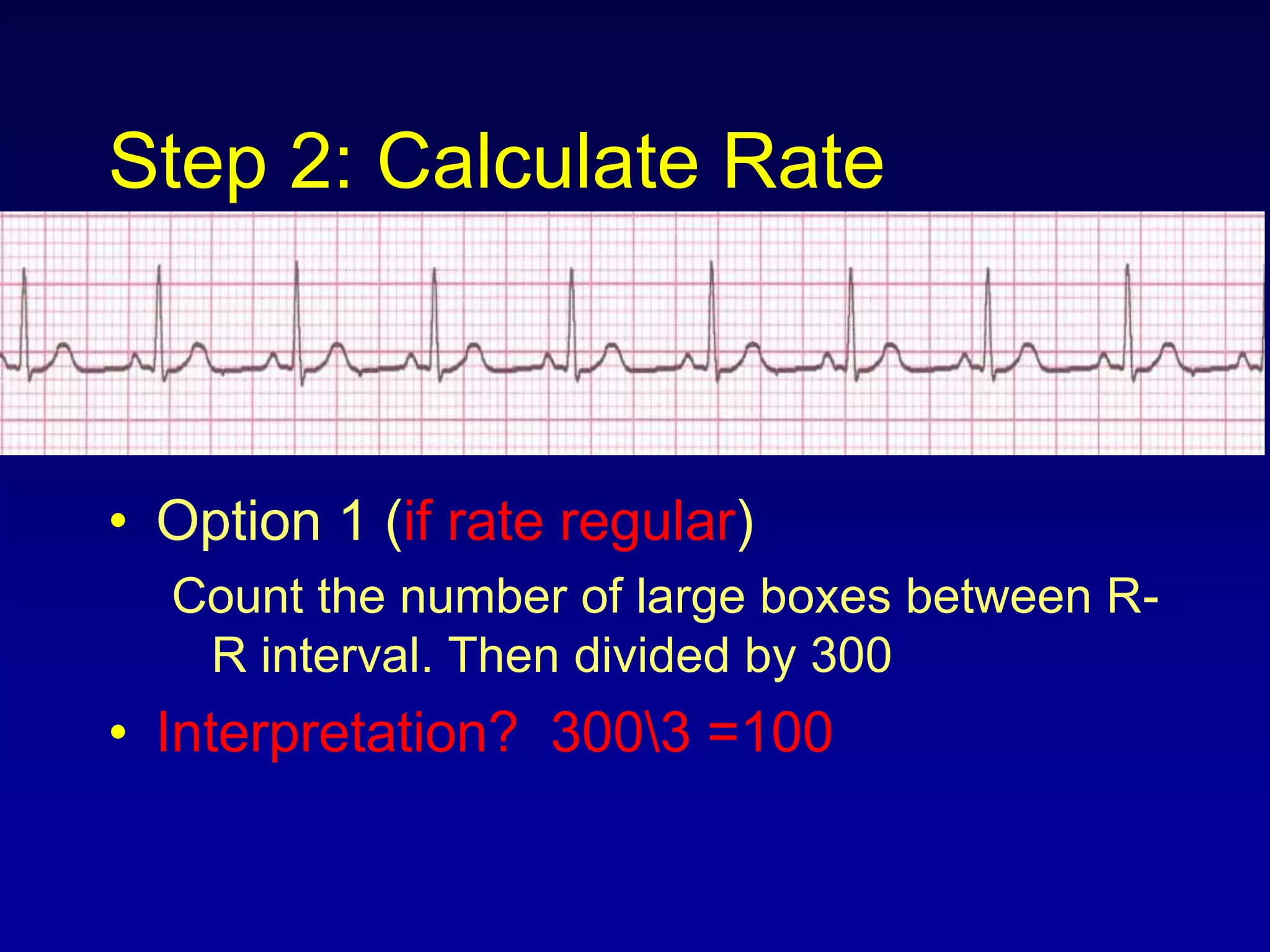 Ecg final the best | PPT