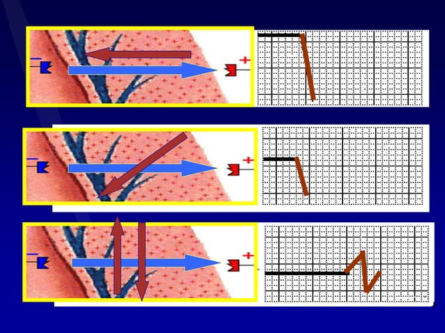 Ecg final the best | PPT
