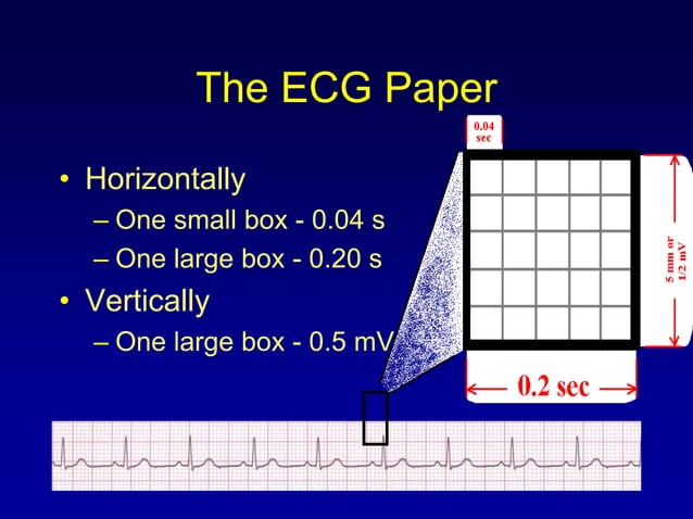 Ecg final the best | PPT
