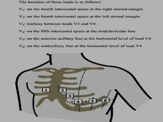 Ecg final the best | PPTX