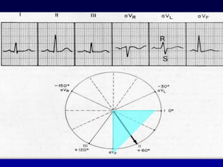 Ecg final the best | PPTX