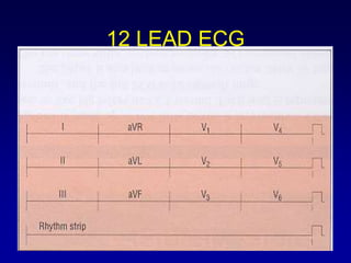 Ecg final the best | PPTX