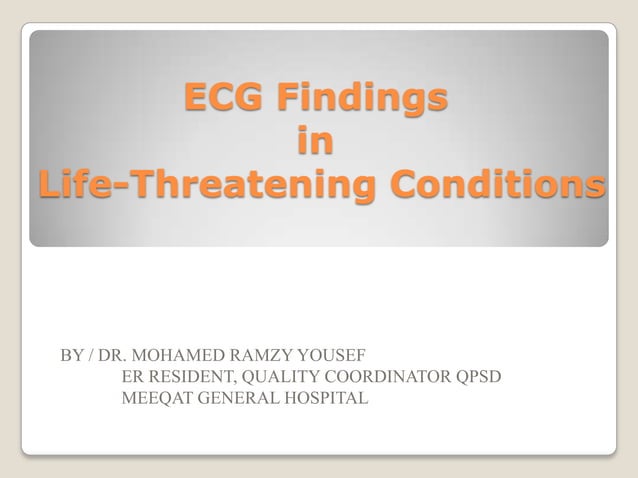 Ecg findings in life threatening conditions | PPTX