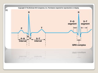 Ecg findings in life threatening conditions | PPTX