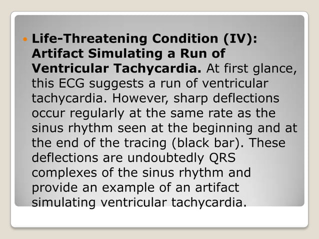 Ecg findings in life threatening conditions | PPTX